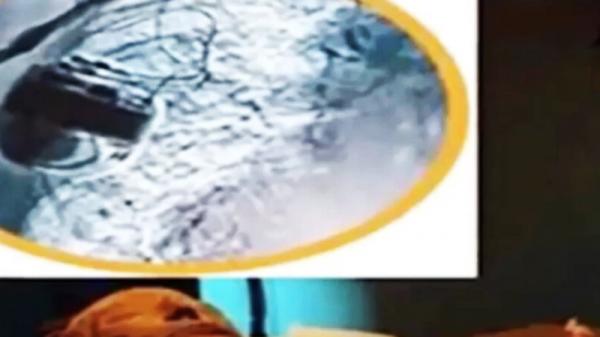 Mysterious pacemaker discovered in ancient Egyptian mummies